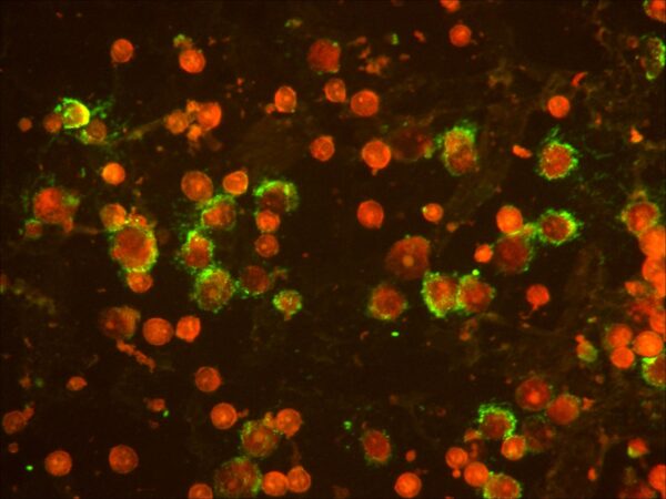 Respiratory Infection Diagnosis by Fluorescence Microscope ...