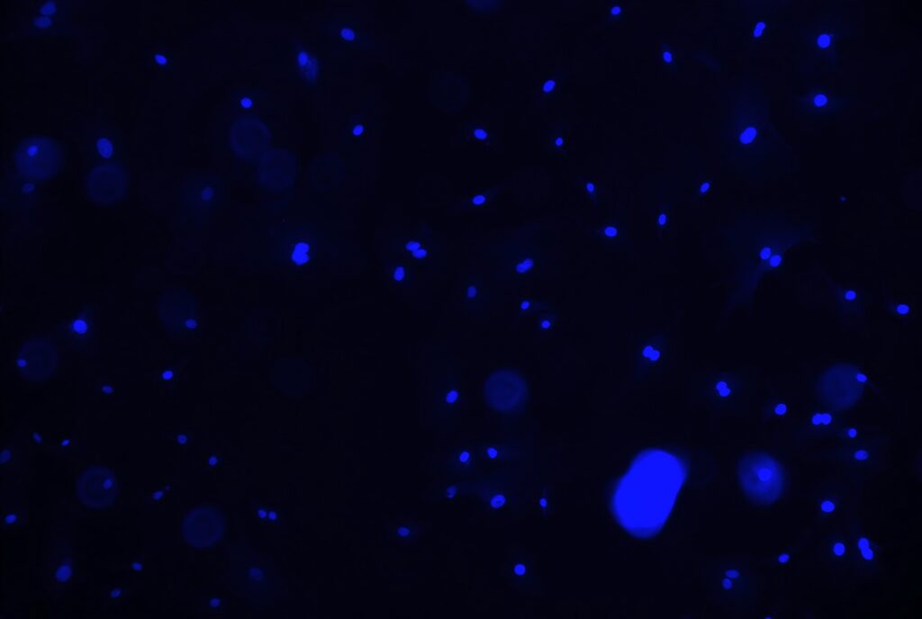 Fluorescence module for Olympus IX73 inverted microscope - Fluorescence ...