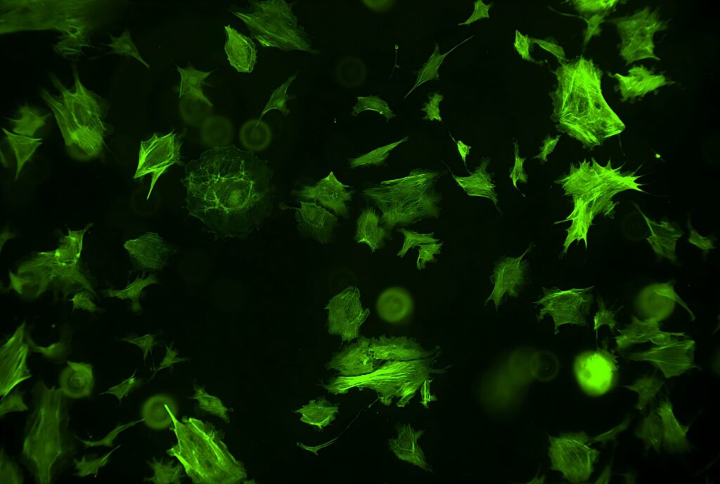 Fluorescence module for Olympus IX73 inverted microscope - Fluorescence ...