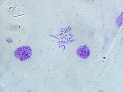 What Type of Microscope is Used for Chromosome Karyotype Analysis ...