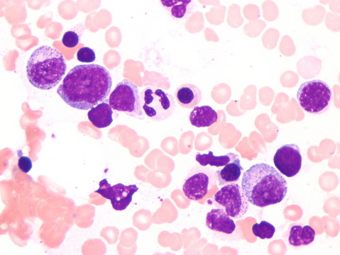 Blood Smear - Fluorescence and Biological microscopes | MSHOT